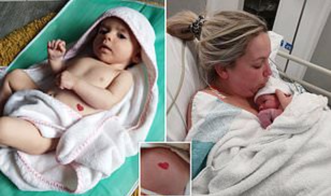 Bayi Ini Lahir dengan Simbol Bayi Ini Lahir dengan Simbol